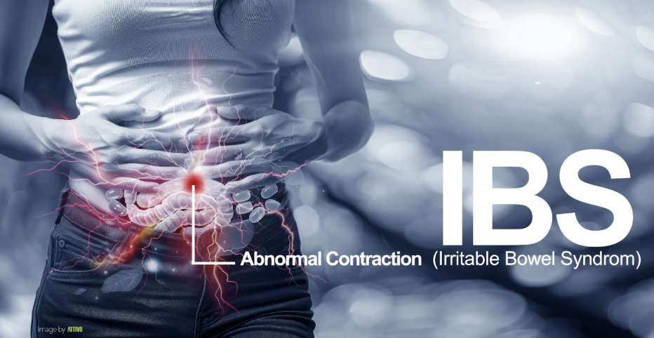 Probiotic Strains for IBS: A Closer Look - Pharm-Dx Malaysia